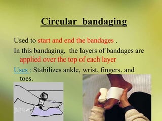 Bandaging technique | PPT