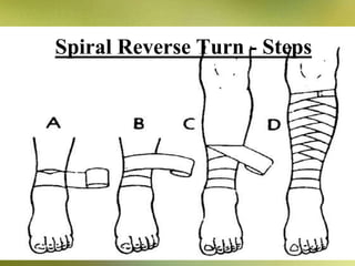 Bandaging technique | PPT