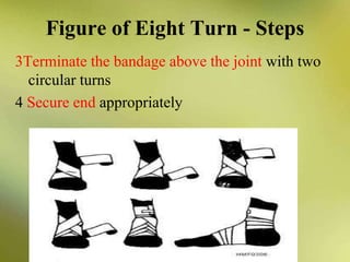 Bandaging technique | PPT