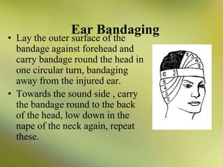 Bandaging technique | PPT