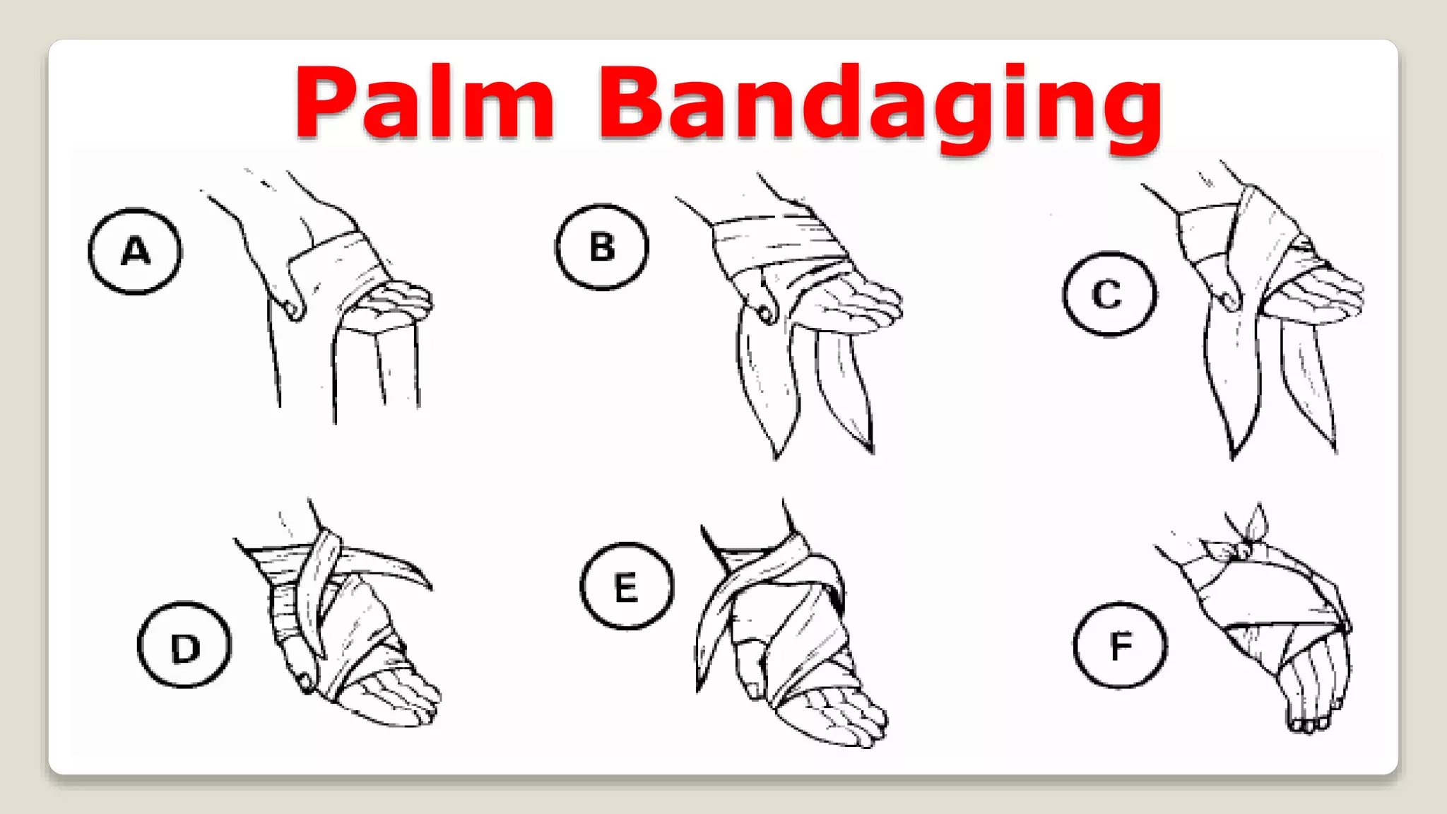 Triangular Bandage Techniques
