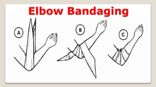 Bandaging Techniques | PPTX