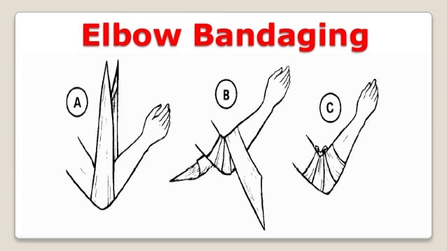 Bandaging Techniques