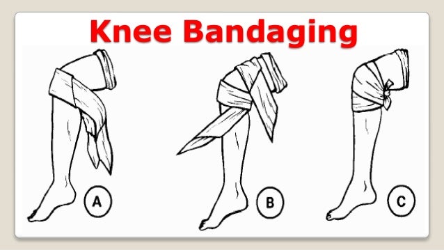 Bandaging Techniques