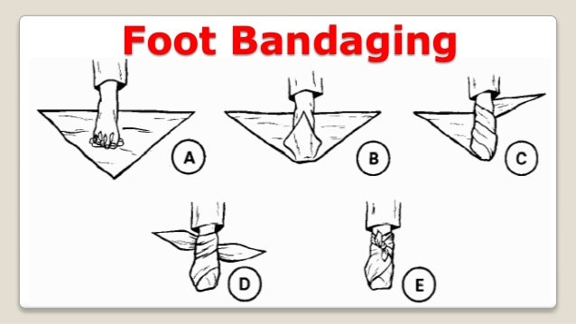Bandaging Techniques