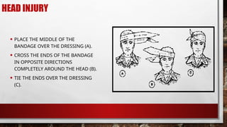 Bandaging with cravat.pptx Disaster Preparedness | PPTX