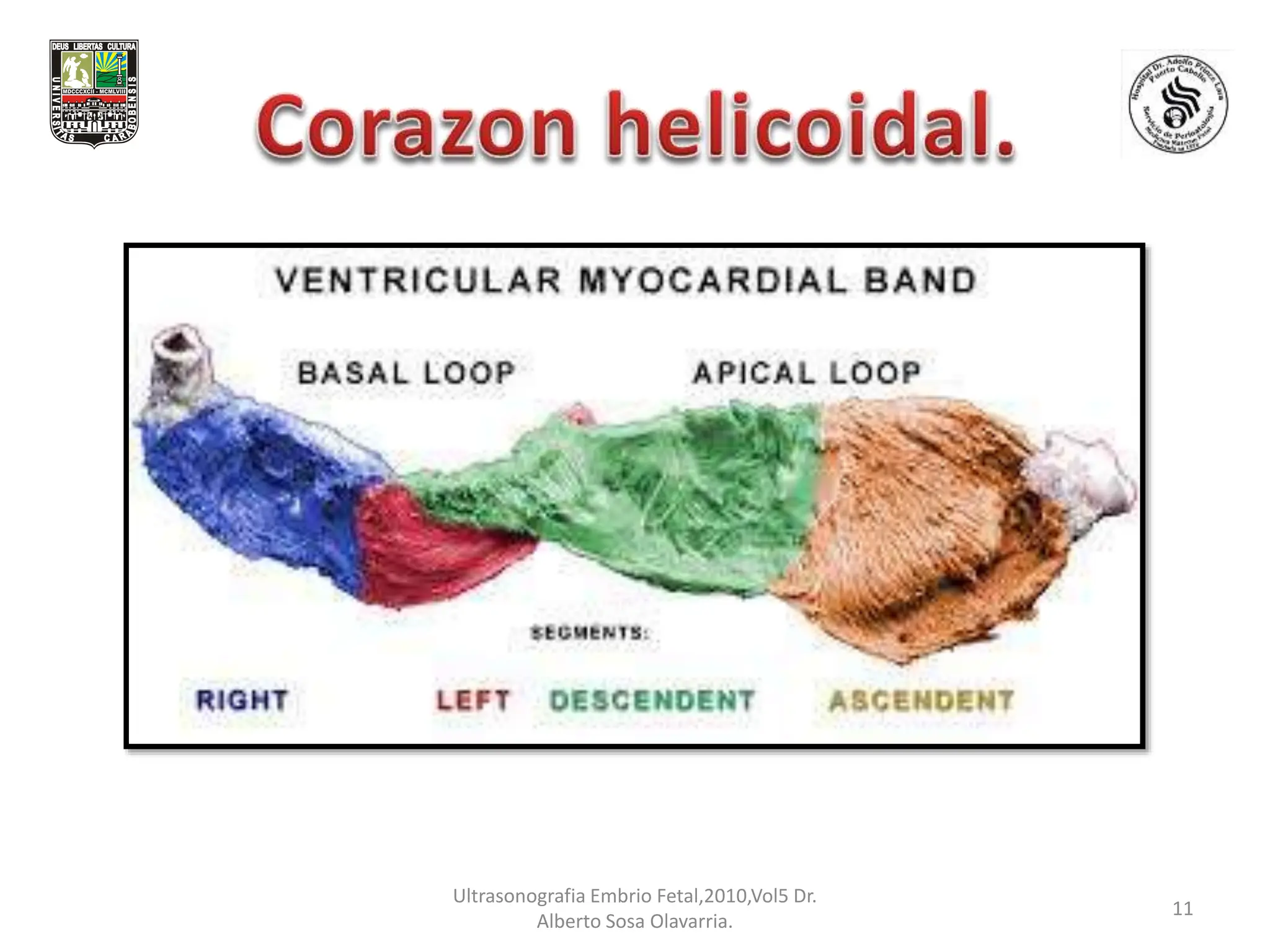 banda miocardica helicoidal.pptx corazon | PPT