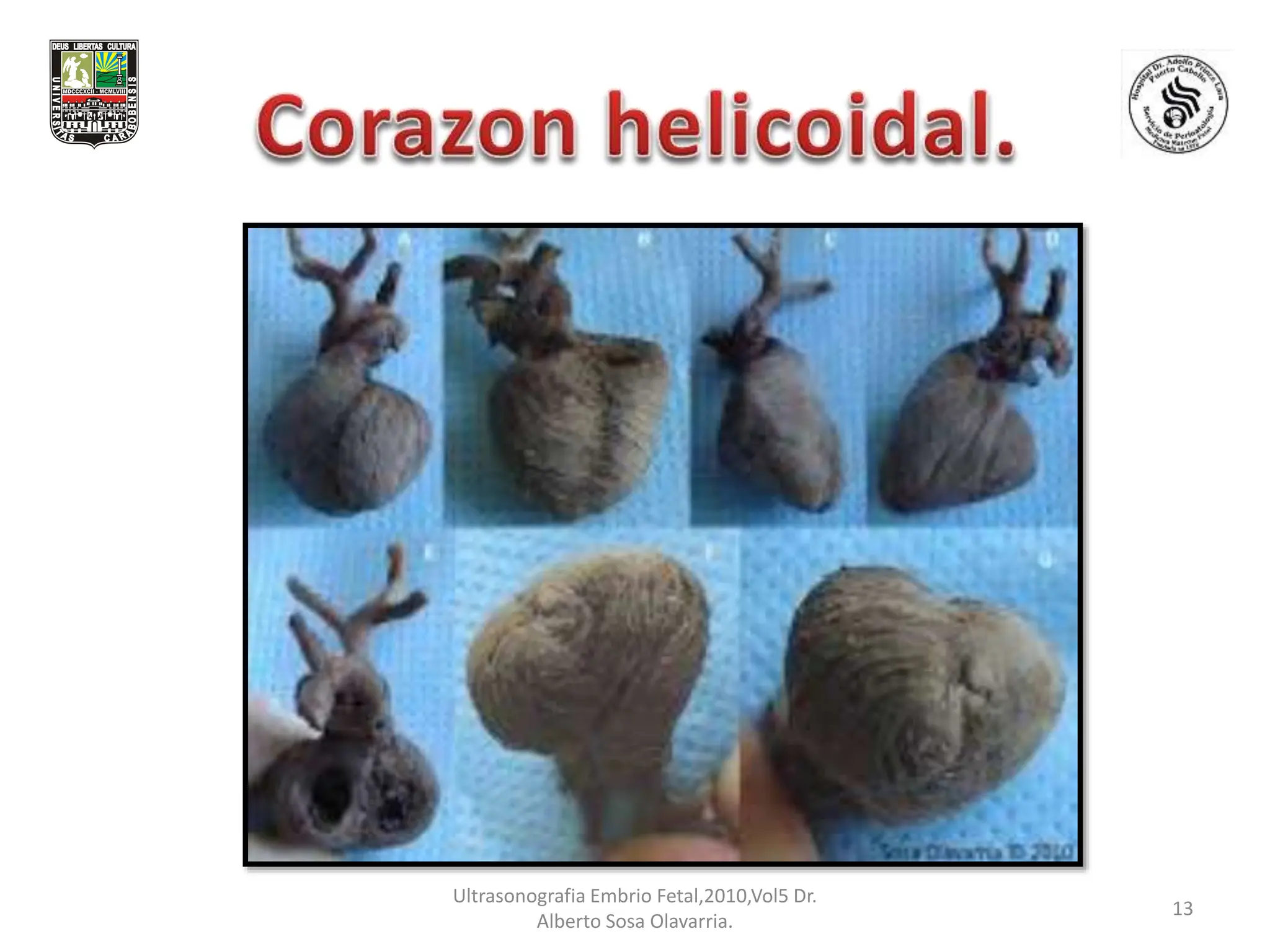 banda miocardica helicoidal.pptx corazon | PPT