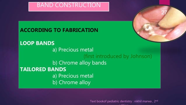 Band and loop space maintainer | PPTX | Dental Health | Diseases and Conditions