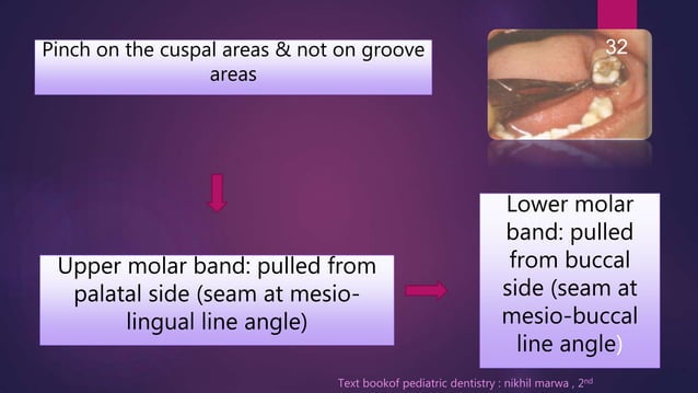 Band and loop space maintainer | PPTX | Dental Health | Diseases and Conditions