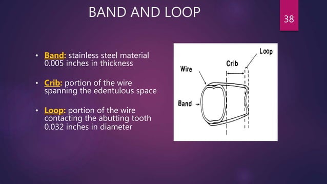 Band and loop space maintainer | PPTX | Dental Health | Diseases and ...