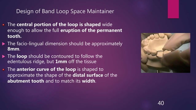Band and loop space maintainer | PPTX | Dental Health | Diseases and Conditions