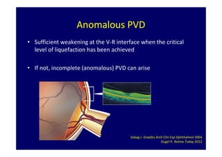 Bandello pharmacological treatment of vitreo macular traction | PPT