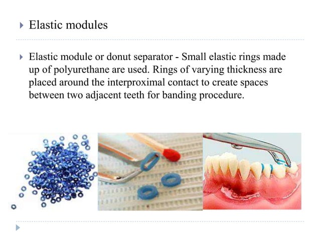 Banding | PPTX | Dental Health | Diseases and Conditions