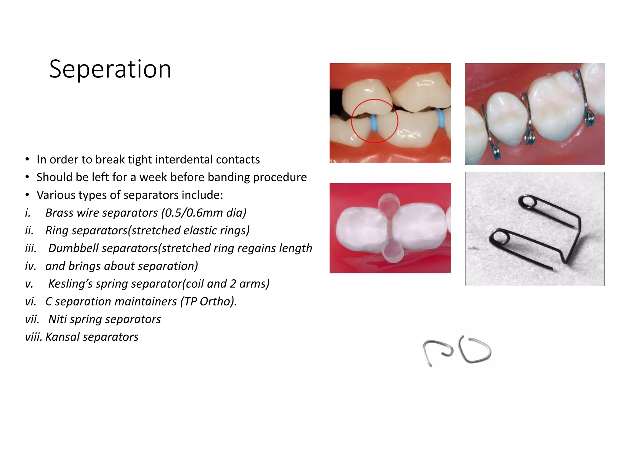Banding procedure and general principles of bonding pdf | PDF
