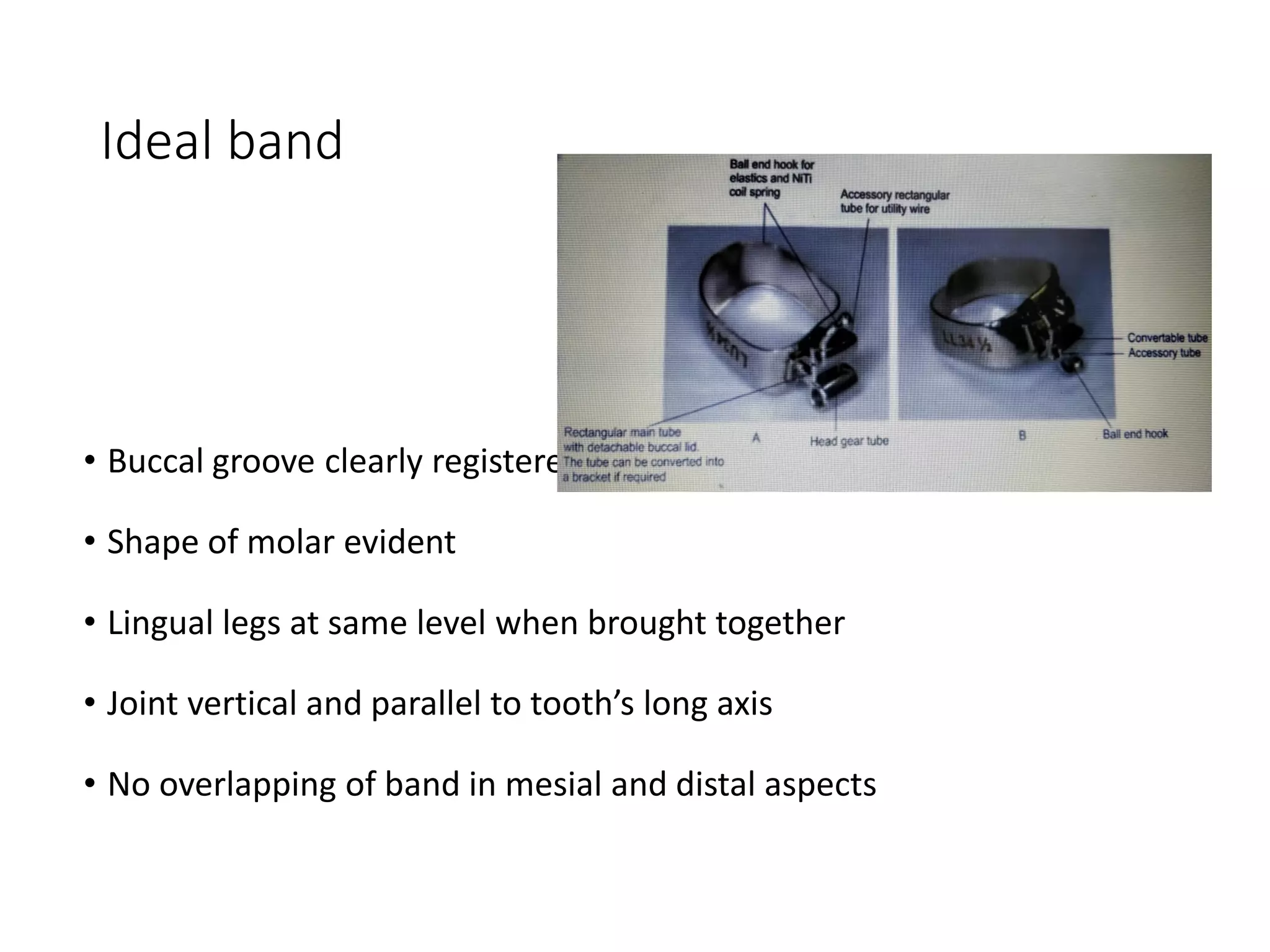 Banding procedure and general principles of bonding pdf | PDF
