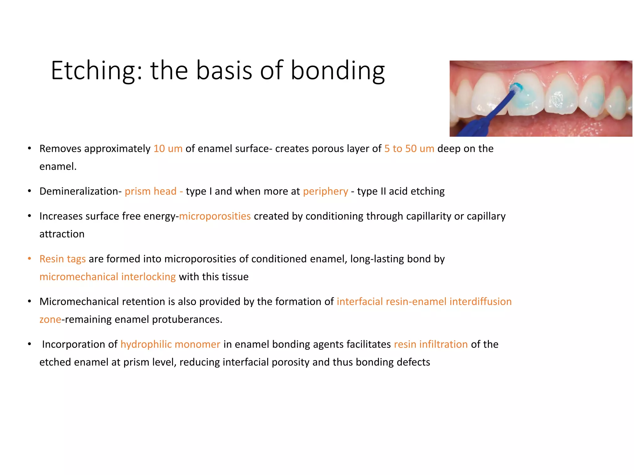 Banding procedure and general principles of bonding pdf | PDF