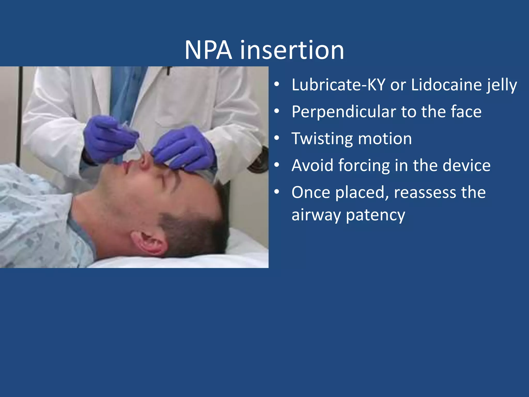 Basic airway management | PPTX