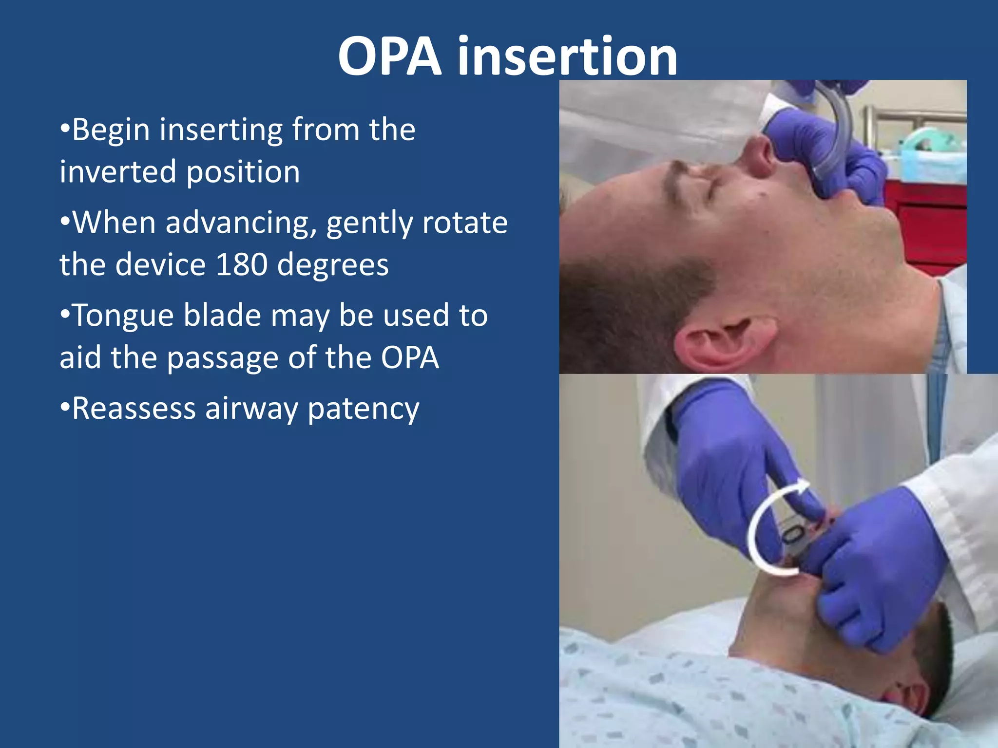 Basic airway management | PPTX