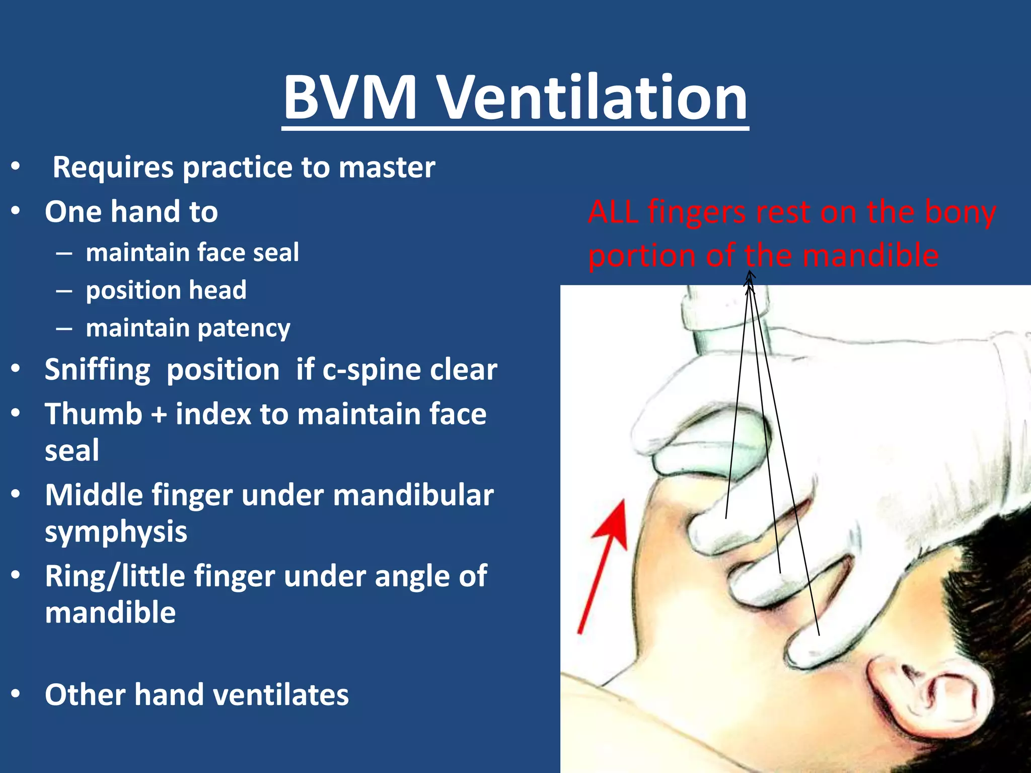 Basic airway management | PPTX