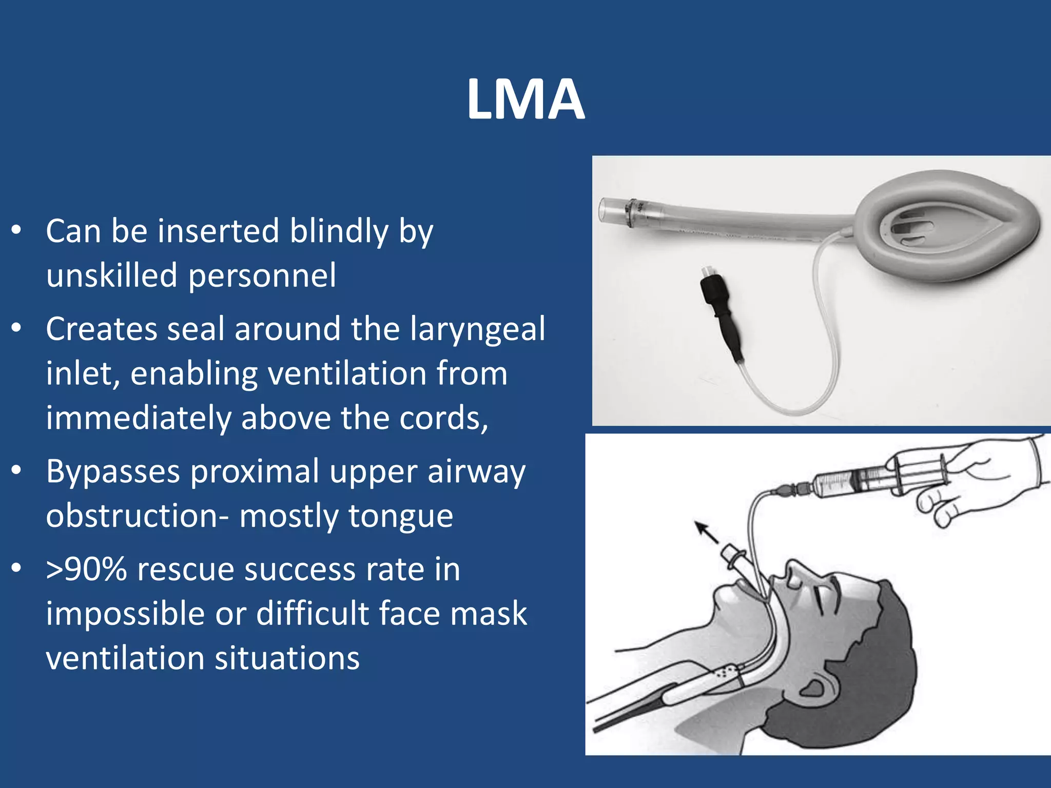 Basic airway management | PPTX