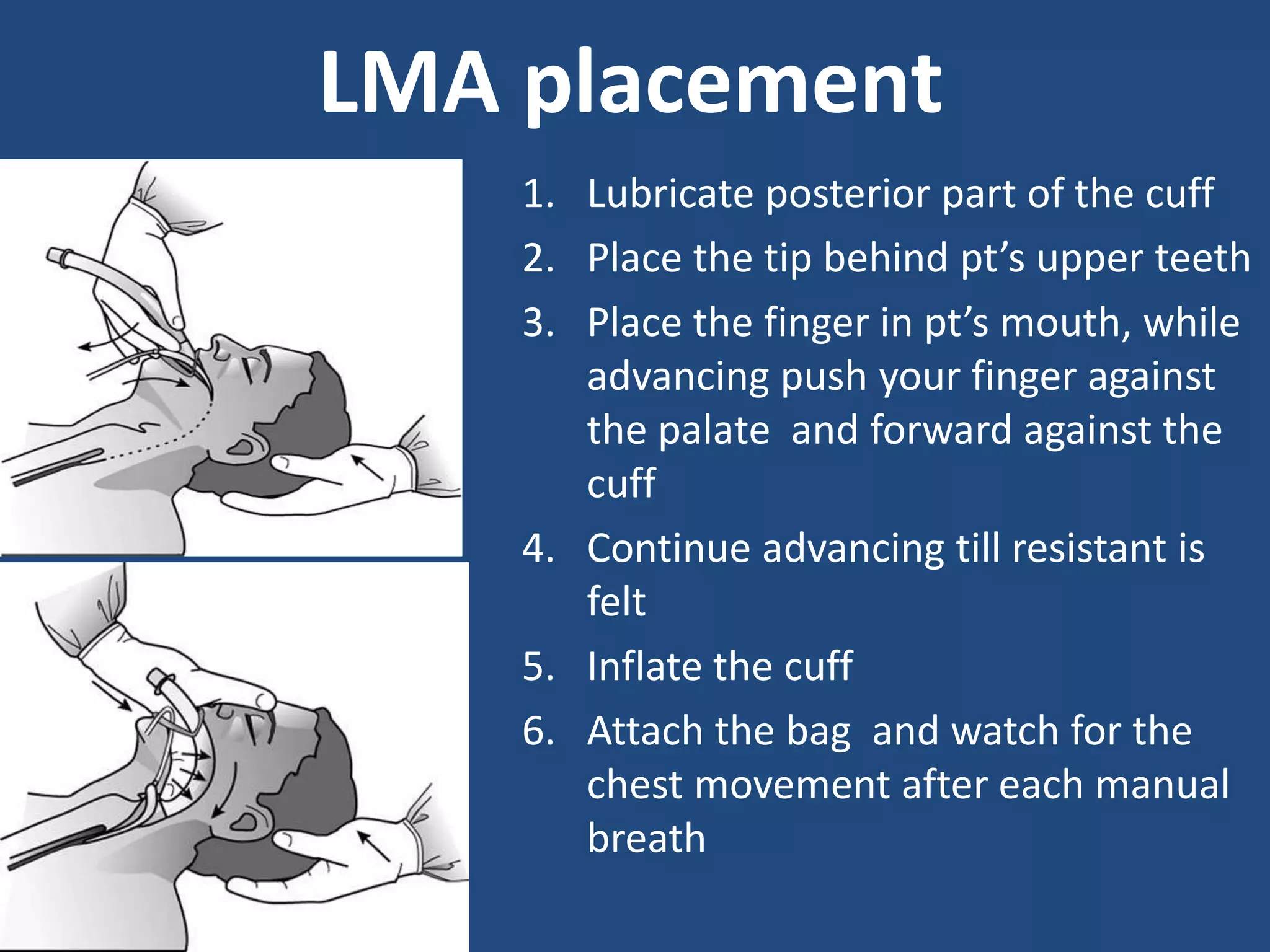 Basic airway management | PPTX