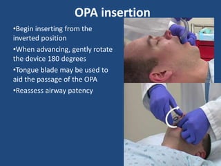 Basic airway management | PPTX | First Aid | Injuries