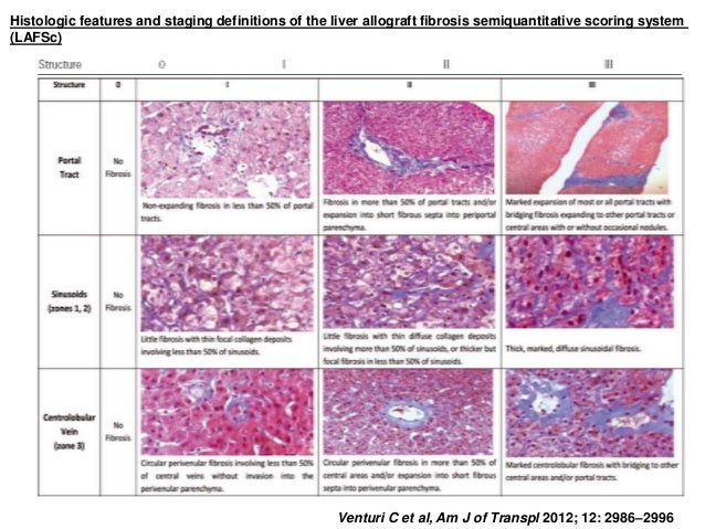 Banff 2013 liver session summary