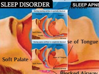 Bangun dan tidur | PPT