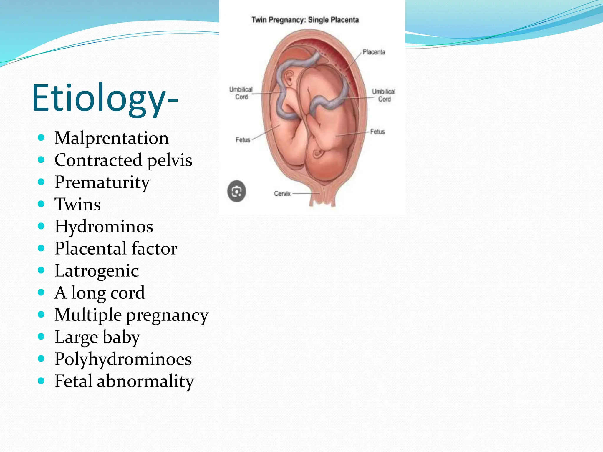 Kiran.pptx,.................. | PPT