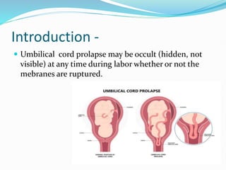 Kiran.pptx,.................. | PPT