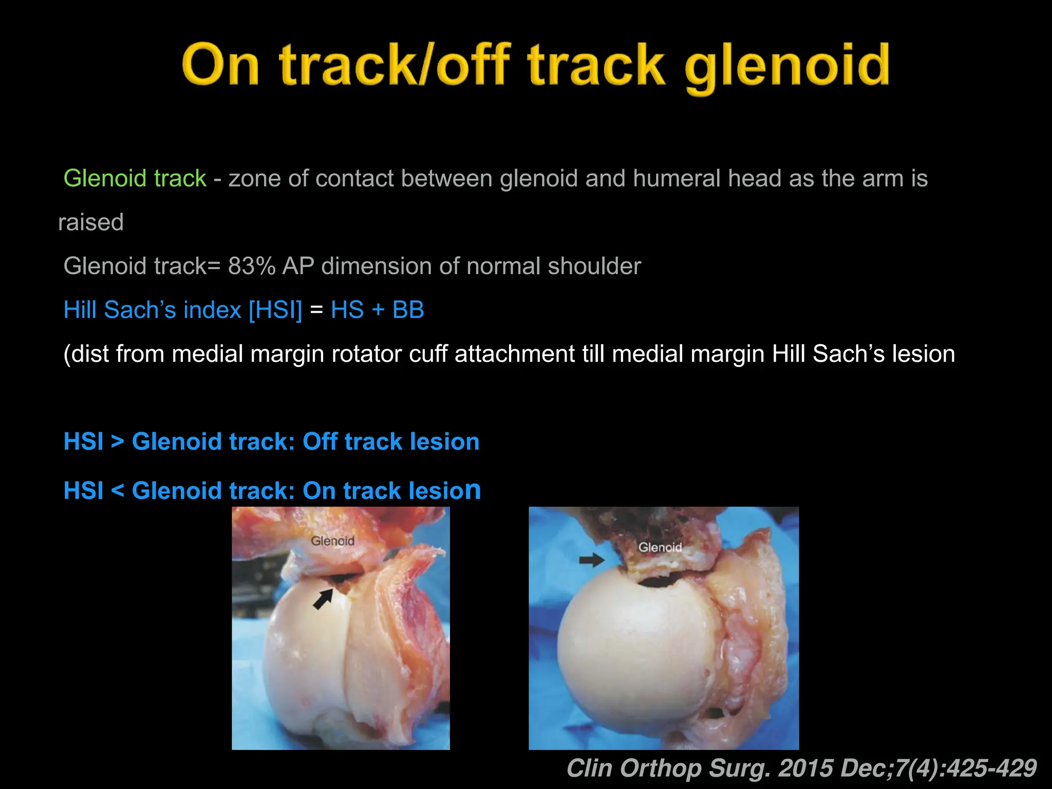 Bankart & Hill Sachs lesions and their repairs | PPTX