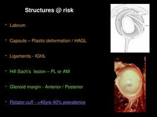 Bankart & Hill Sachs lesions and their repairs | PPTX