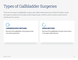Banner Health - Gallbladder Surgery | PPT