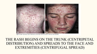 All information available from definition and treatment | PPTX