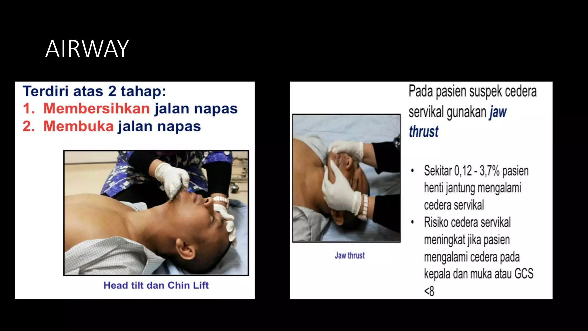 Bantuan hidup dasar 2020 | PPTX