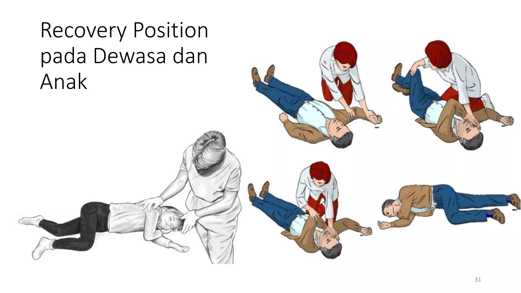 Bantuan Hidup Dasar BLS .pptx