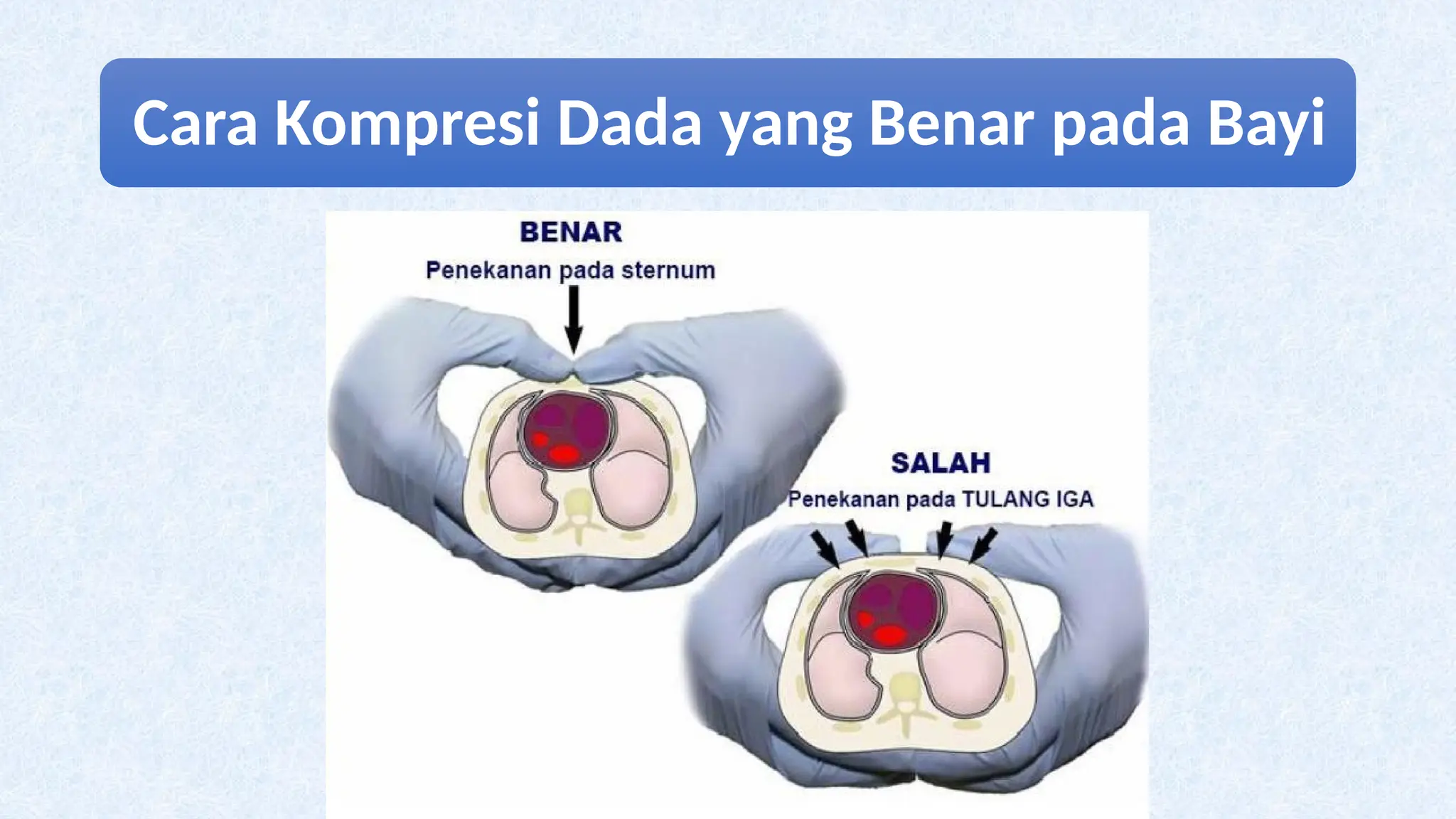 MATERI PELATIHAN PENGANTAR BANTUAN HIDUP DASAR .pptx
