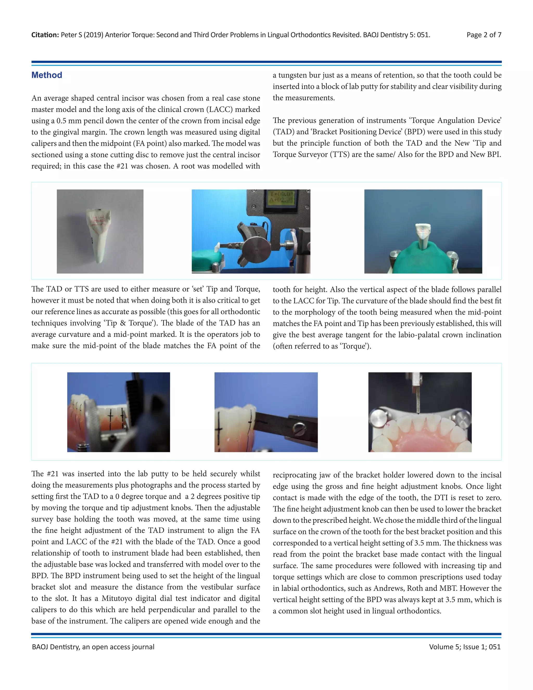 Anterior Torque: Second and Third order Problems in Lingual ...