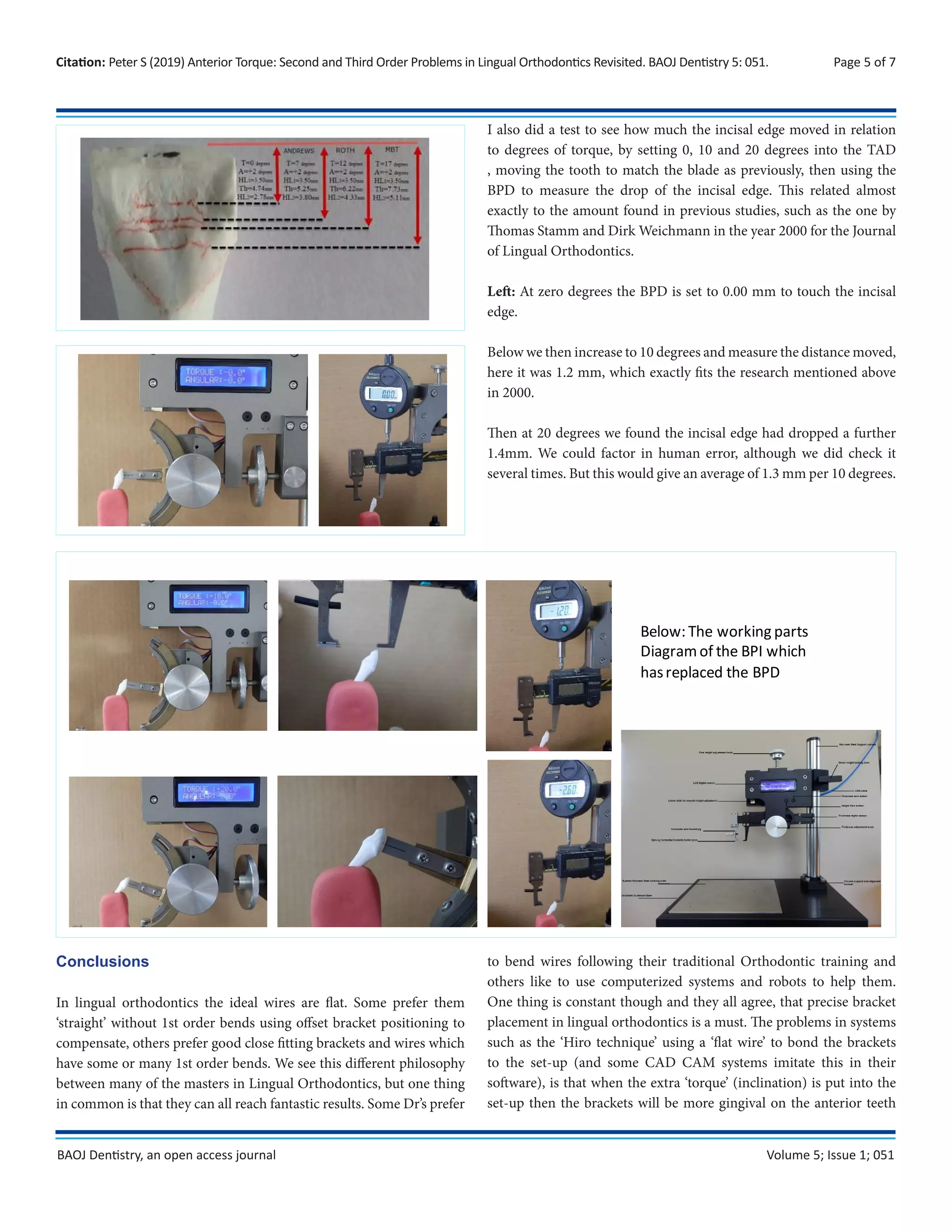 Anterior Torque: Second and Third order Problems in Lingual ...