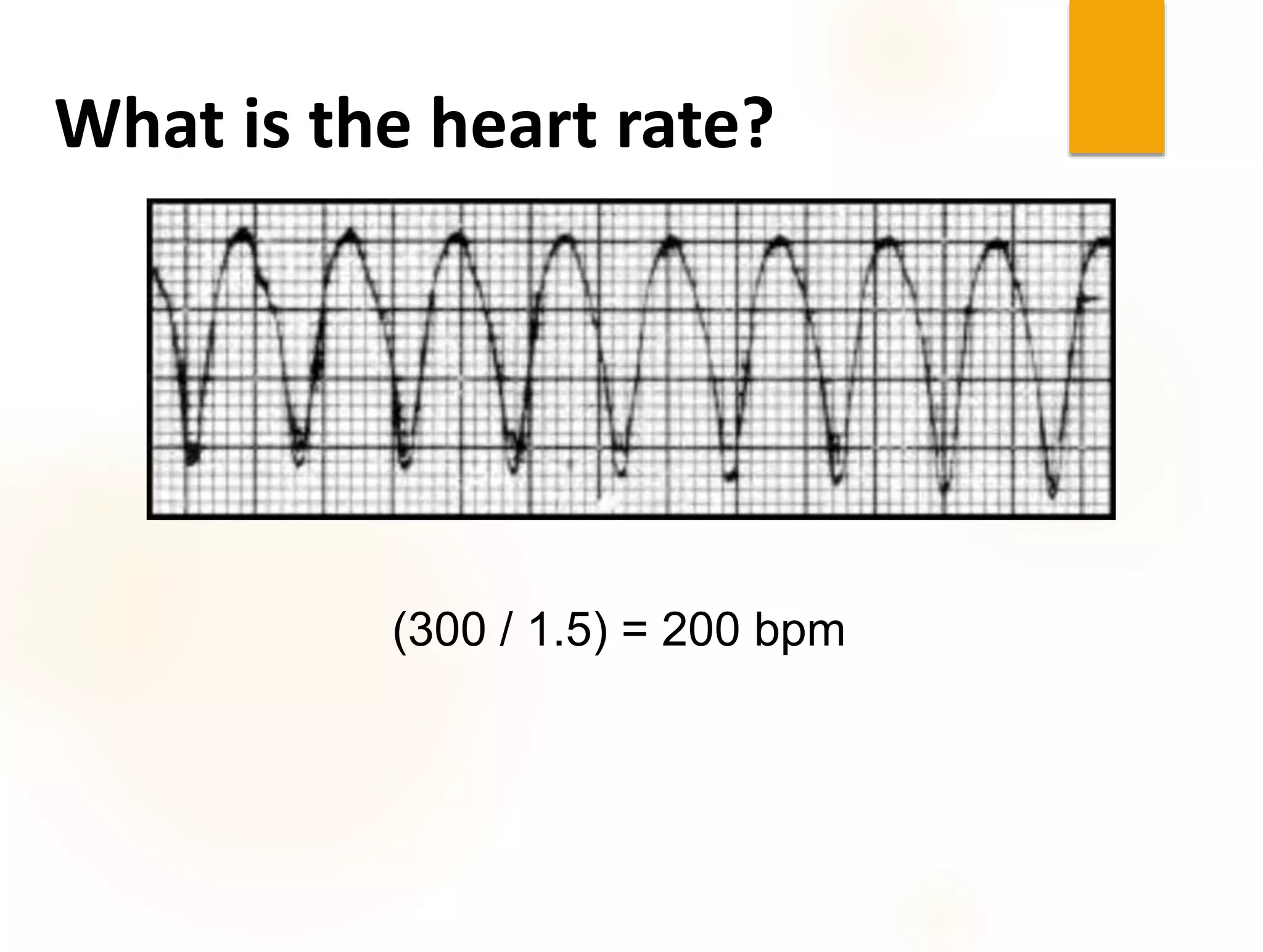 Baral ecg ppt-ecg | PPT