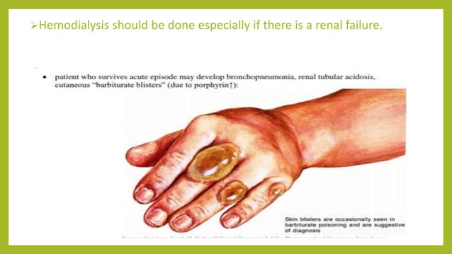 Barbiturate poisoning (pharmacology) | PPTX | Chemistry | Science