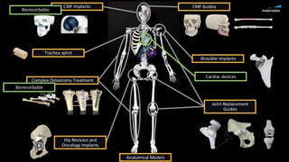 Materialise empowers sustainable 3D printing applications | PDF