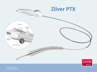 Bare-Metal-Stent-Self-Expandable-stent-balloon-expandable-stent.pptx