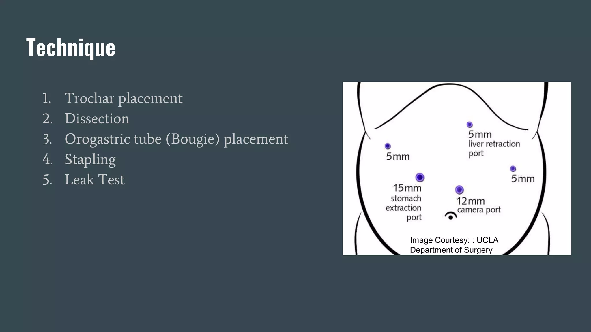 Bariactic surgery.pptx