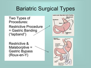 Bariatric service line – lessons learned | PDF