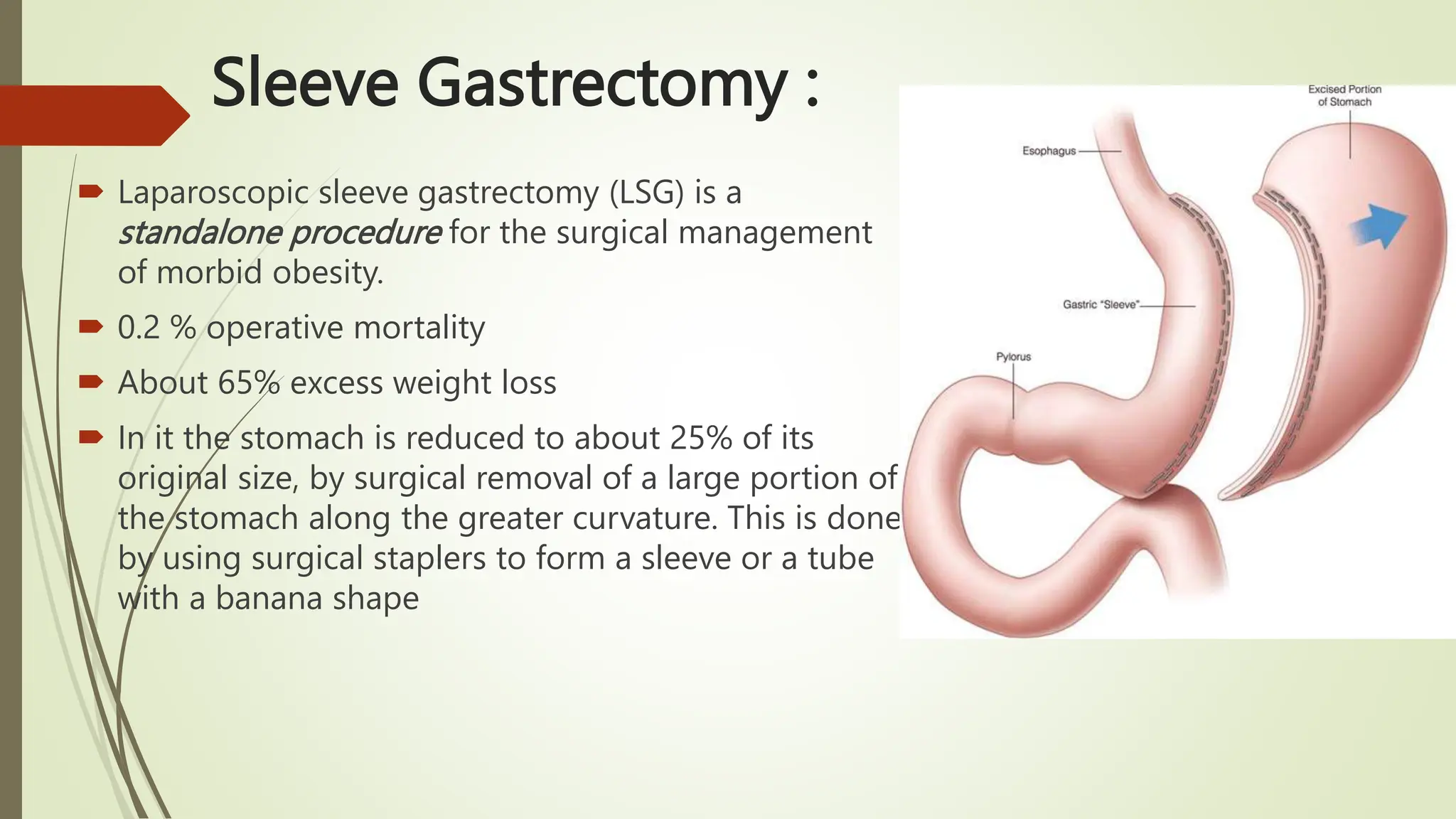 Bariatric surgery by Dr Muhammad Naeem Yousaf.pptx