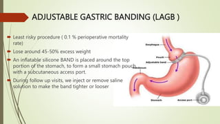Bariatric surgery by Dr Muhammad Naeem Yousaf.pptx