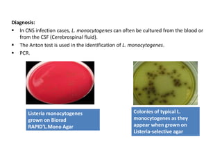 BACTERIAL DISEASES OF FOXES | PPTX