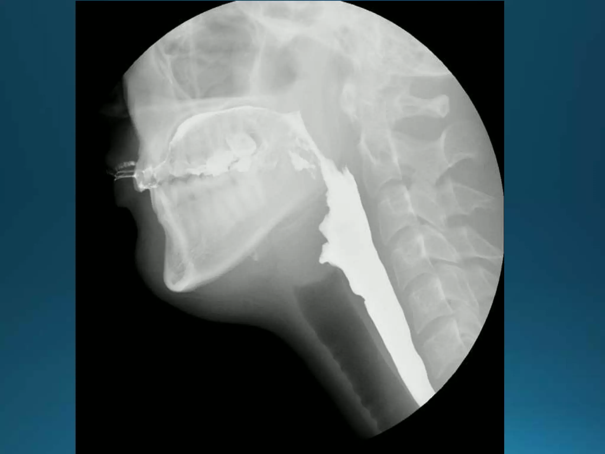 Basics of Barium Imaging | PPTX